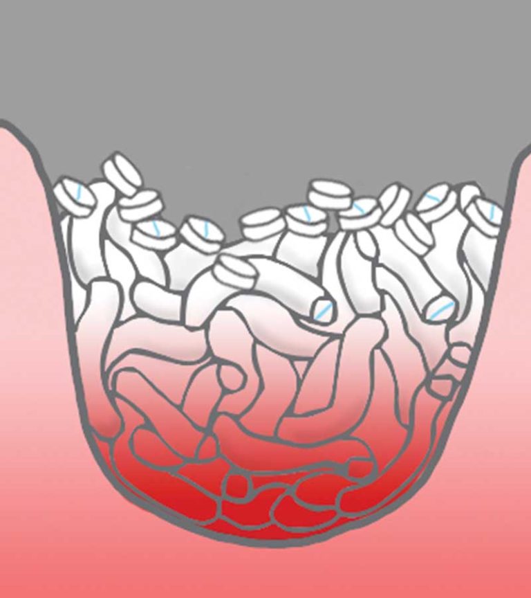XSTAT® P30 | Panakeia, LLC.